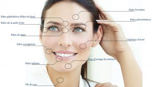 Les traitements efficaces contre les rides et ridules